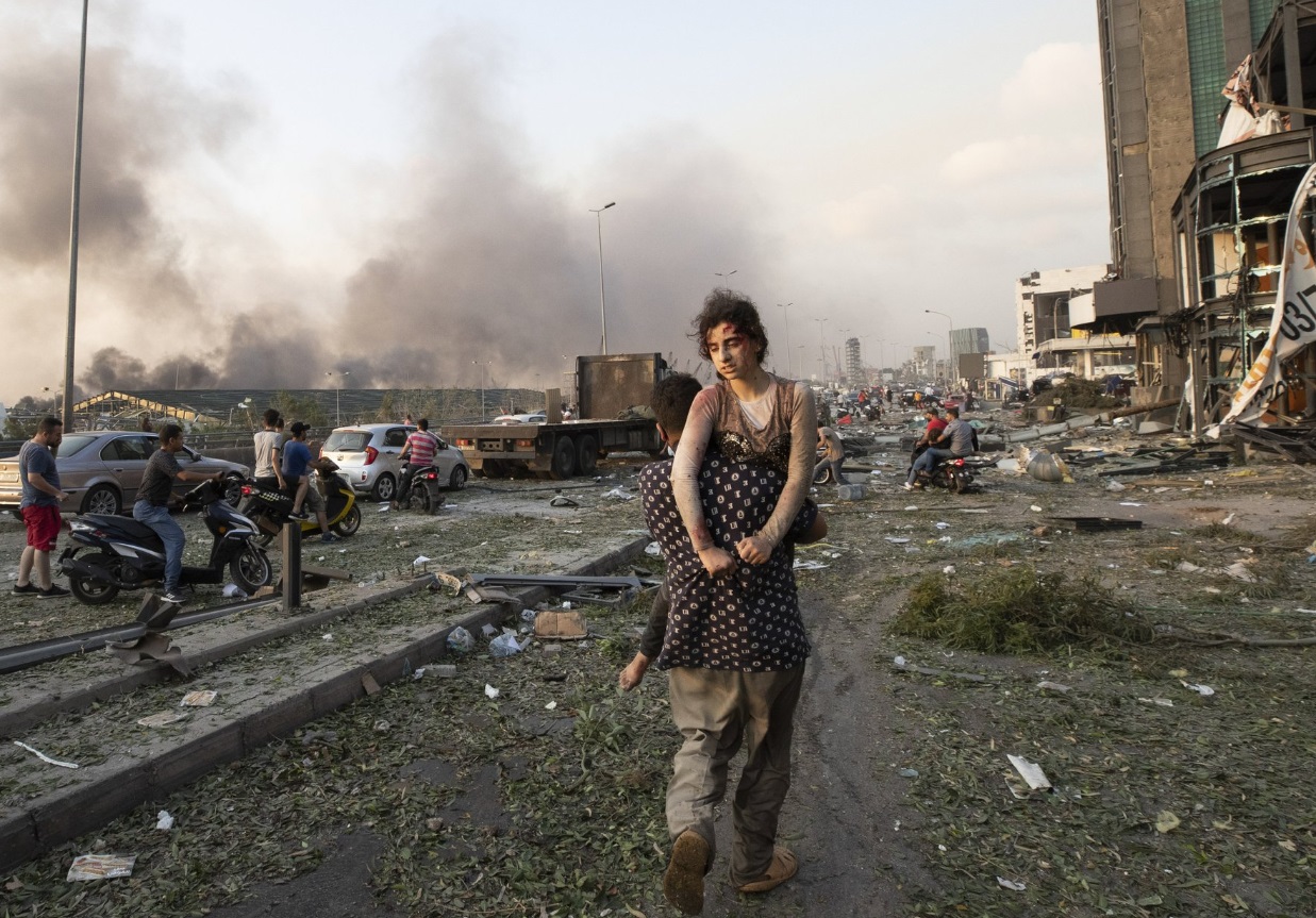 Bayaning Pinay, iniligtas ang kaniyang mga alaga sa matinding pagsabog ...